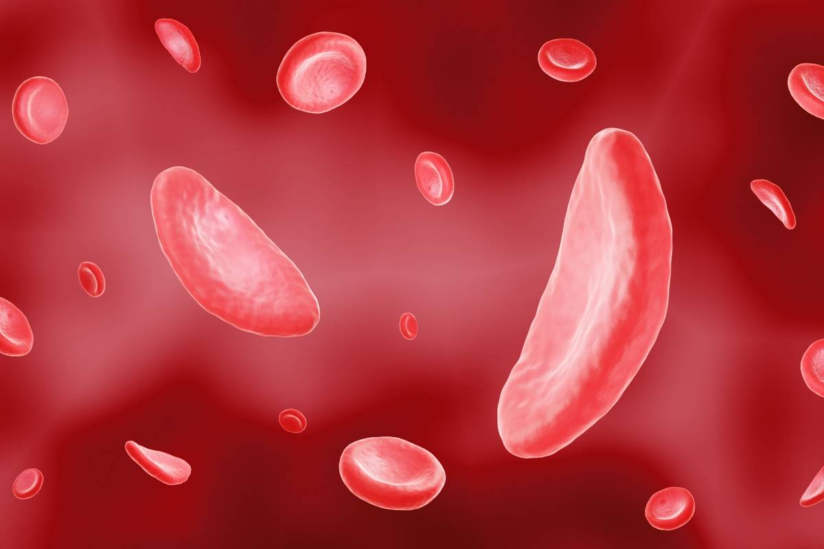 What’s coming next in SCD medication?